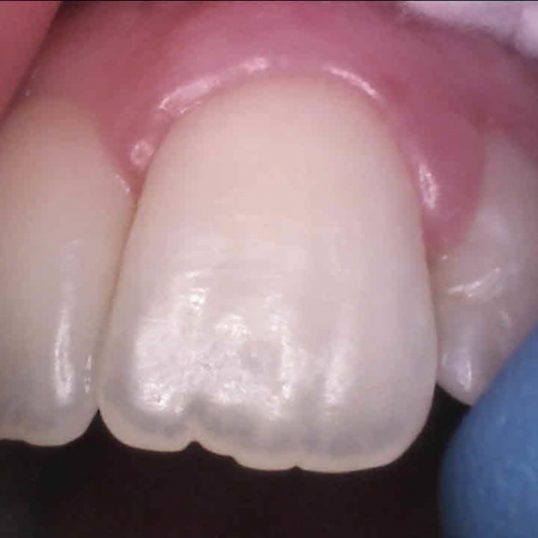 Smile Gallery - Waiheke Dental